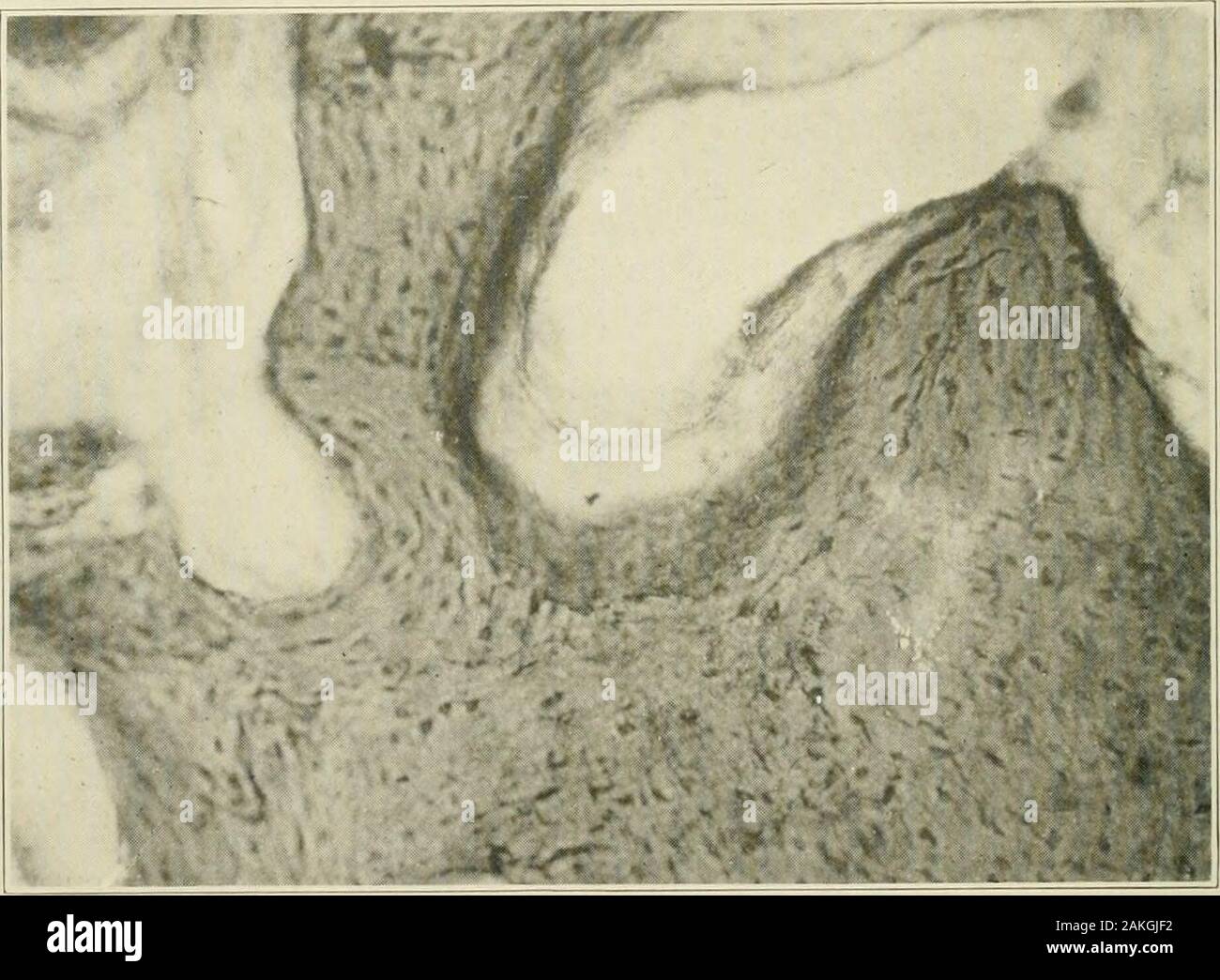 Cortical bone immagini e fotografie stock ad alta risoluzione - Alamy
