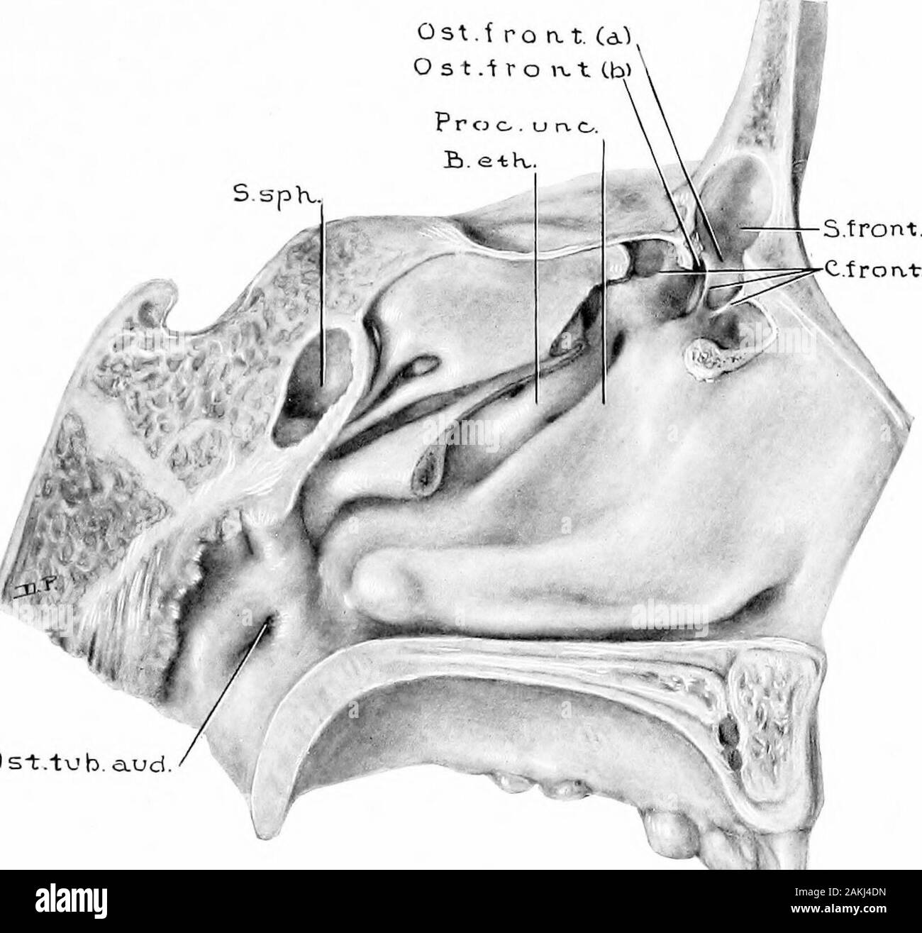 Anatomia Del Seno Etmoidale