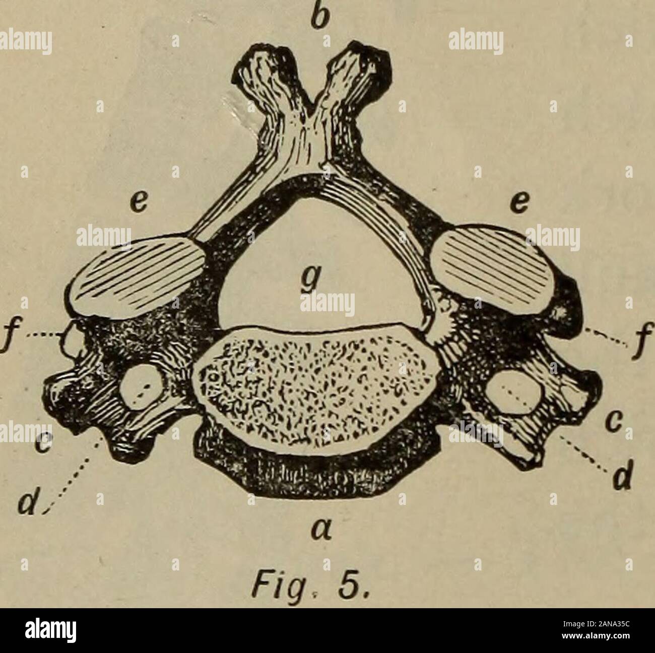 Processo spinoso delle ossa immagini e fotografie stock ad alta ...