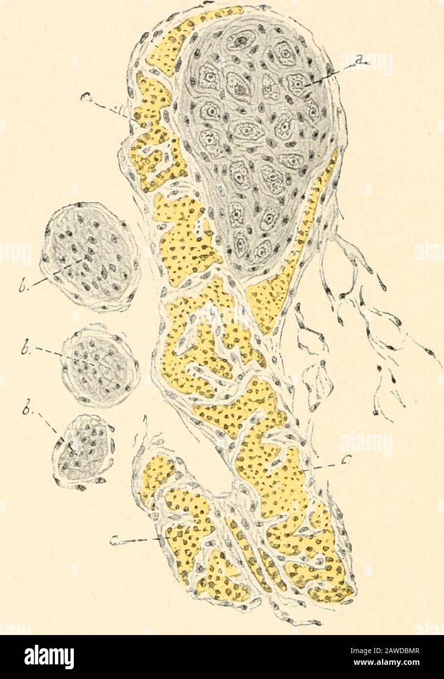Morbo Di Addison Immagini e Fotos Stock - Alamy