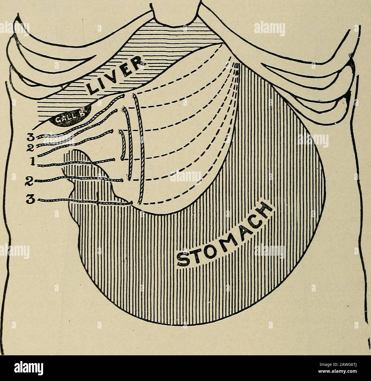 Spina iliaca anterior superior immagini e fotografie stock ad alta ...