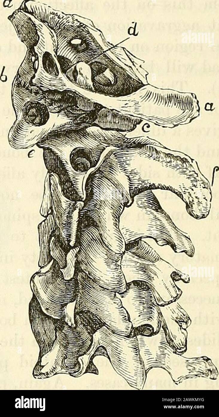 Un sistema di chirurgia: Teorico e pratico iter, alarge gonfiore si ...