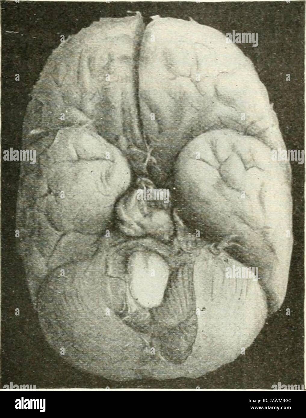 Sella turcica immagini e fotografie stock ad alta risoluzione - Alamy