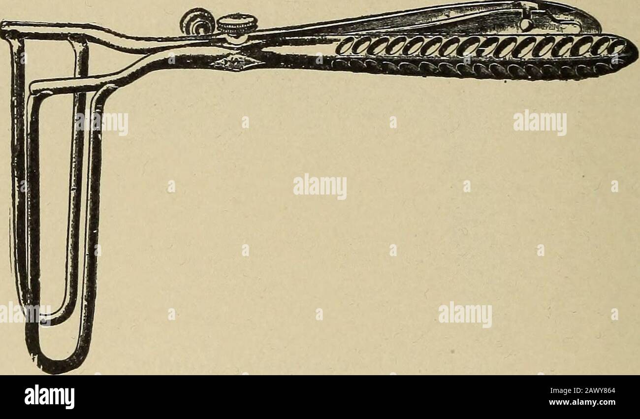 Diagnosi ginecologica . sebbene faccia those1 dell'ampolla. La mucosa ...