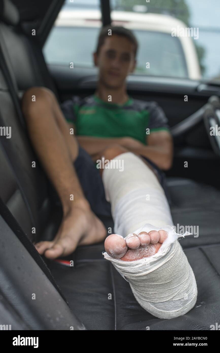 Bambino gamba rotta gesso immagini e fotografie stock ad alta ...