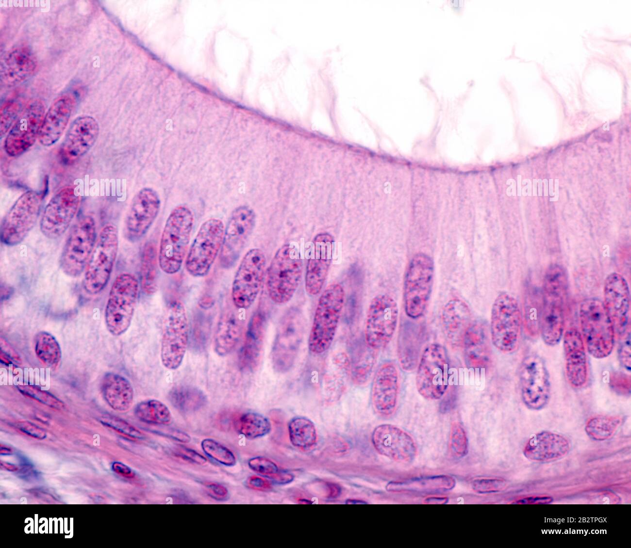 Tessuto epiteliale microscopio immagini e fotografie stock ad alta ...