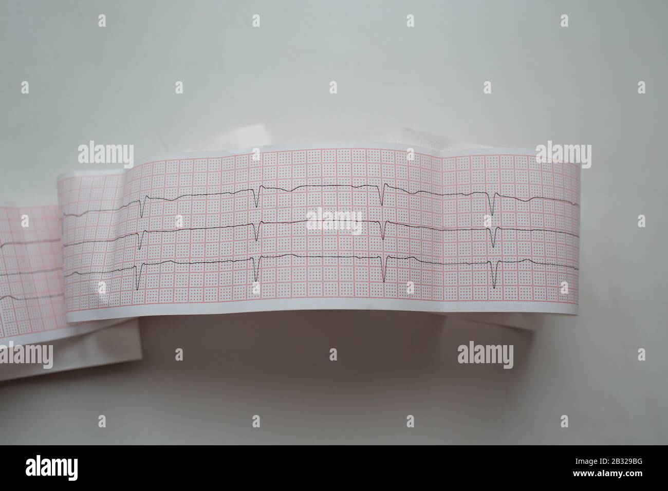 Carta ecg immagini e fotografie stock ad alta risoluzione - Alamy