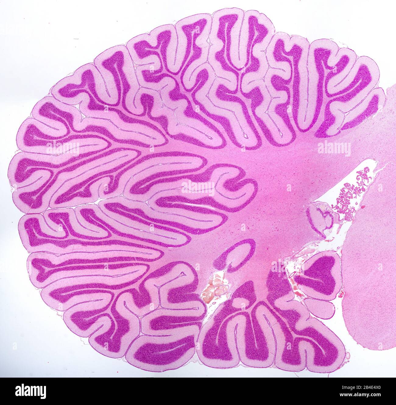 Ematossilina eosina immagini e fotografie stock ad alta risoluzione - Alamy