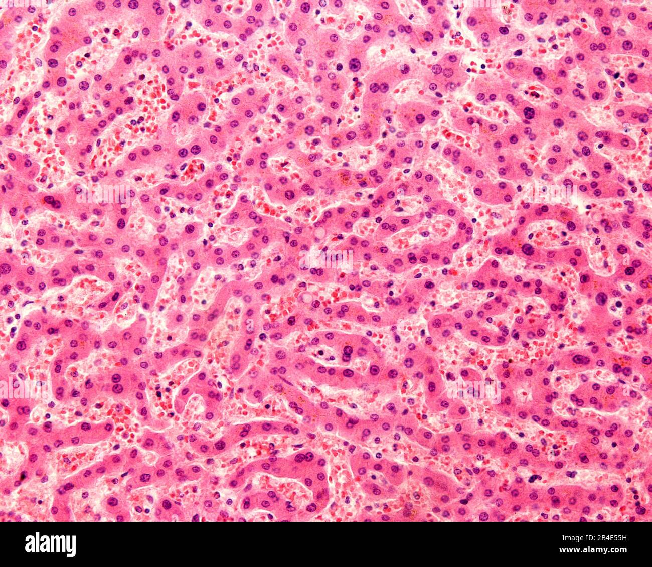 Micrografia leggera di un fegato umano colorato con ematossilina ed ...