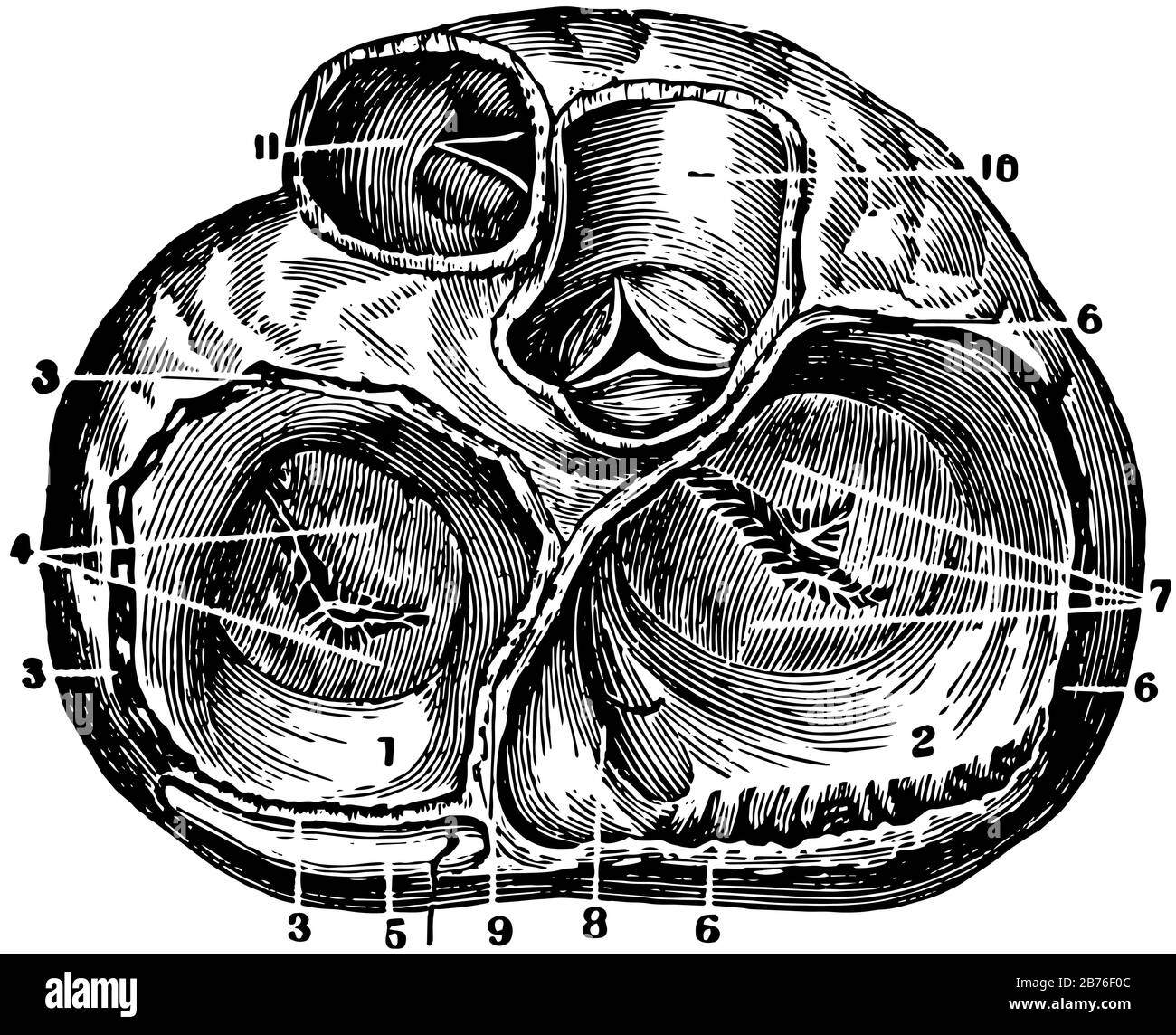Valvole cardiaca Foto e Immagini Stock in Bianco e Nero - Alamy