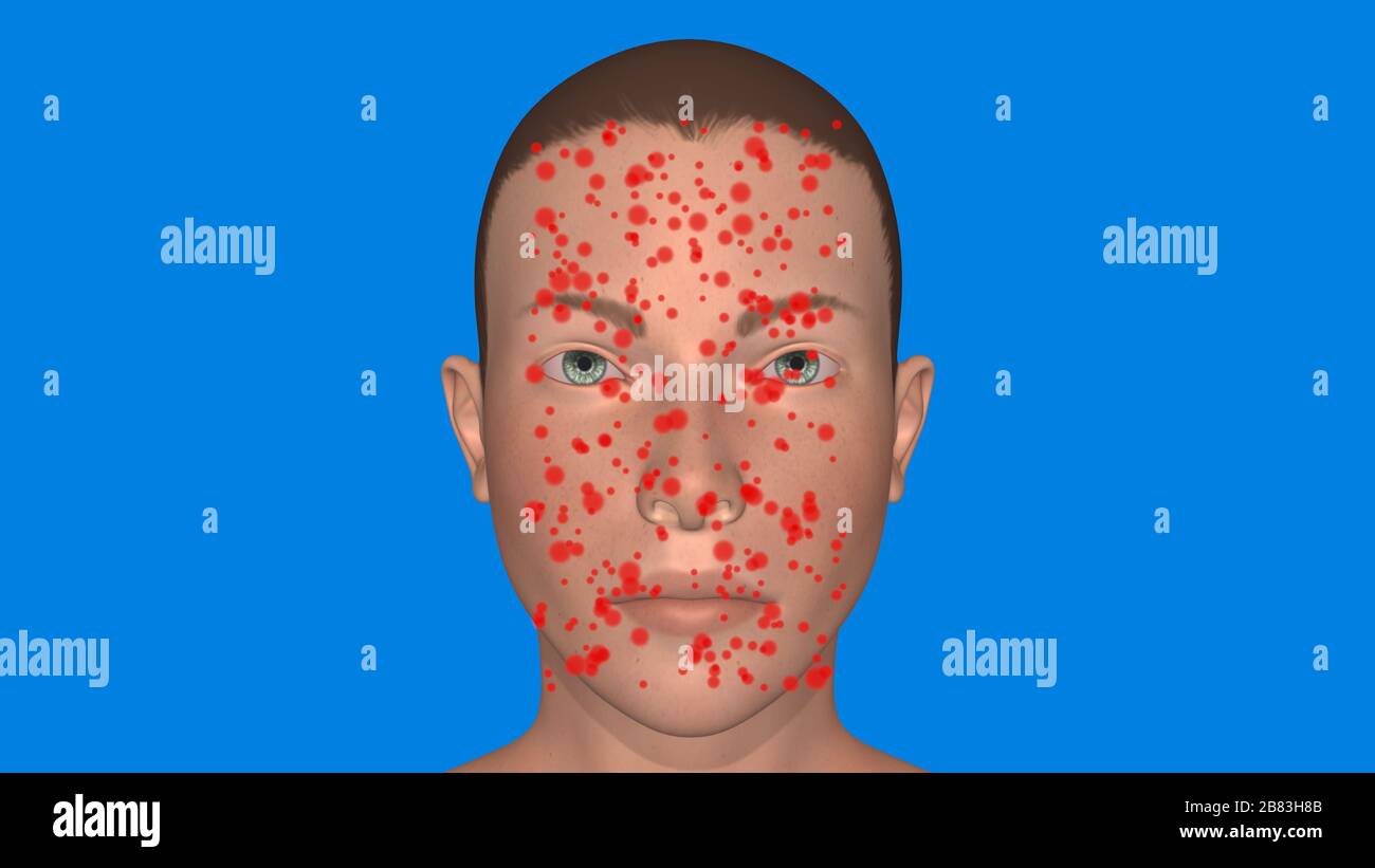 Microbiota cutaneo immagini e fotografie stock ad alta risoluzione - Alamy