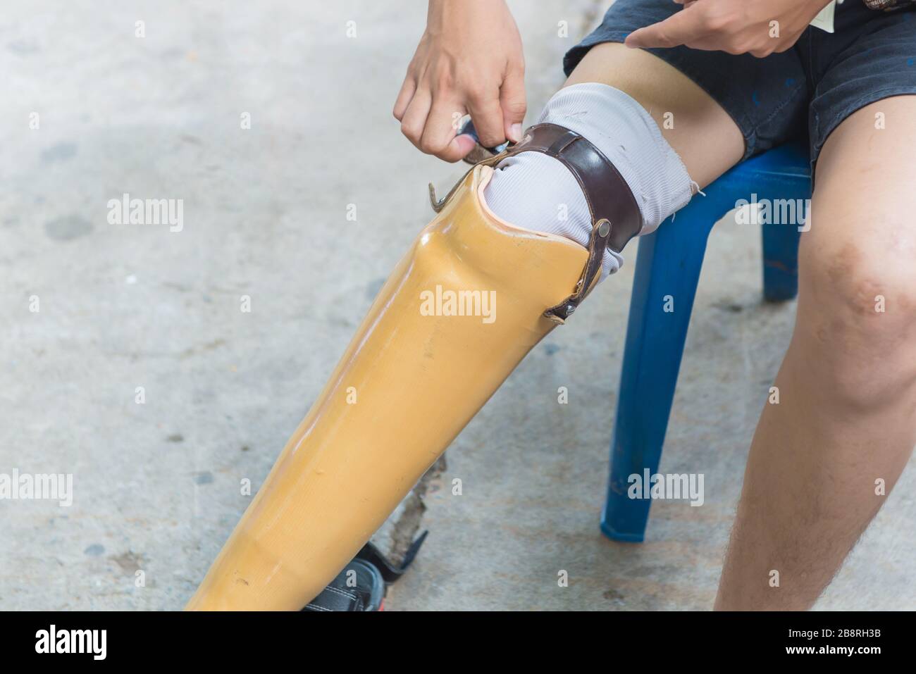 Protesi di gamba immagini e fotografie stock ad alta risoluzione - Alamy
