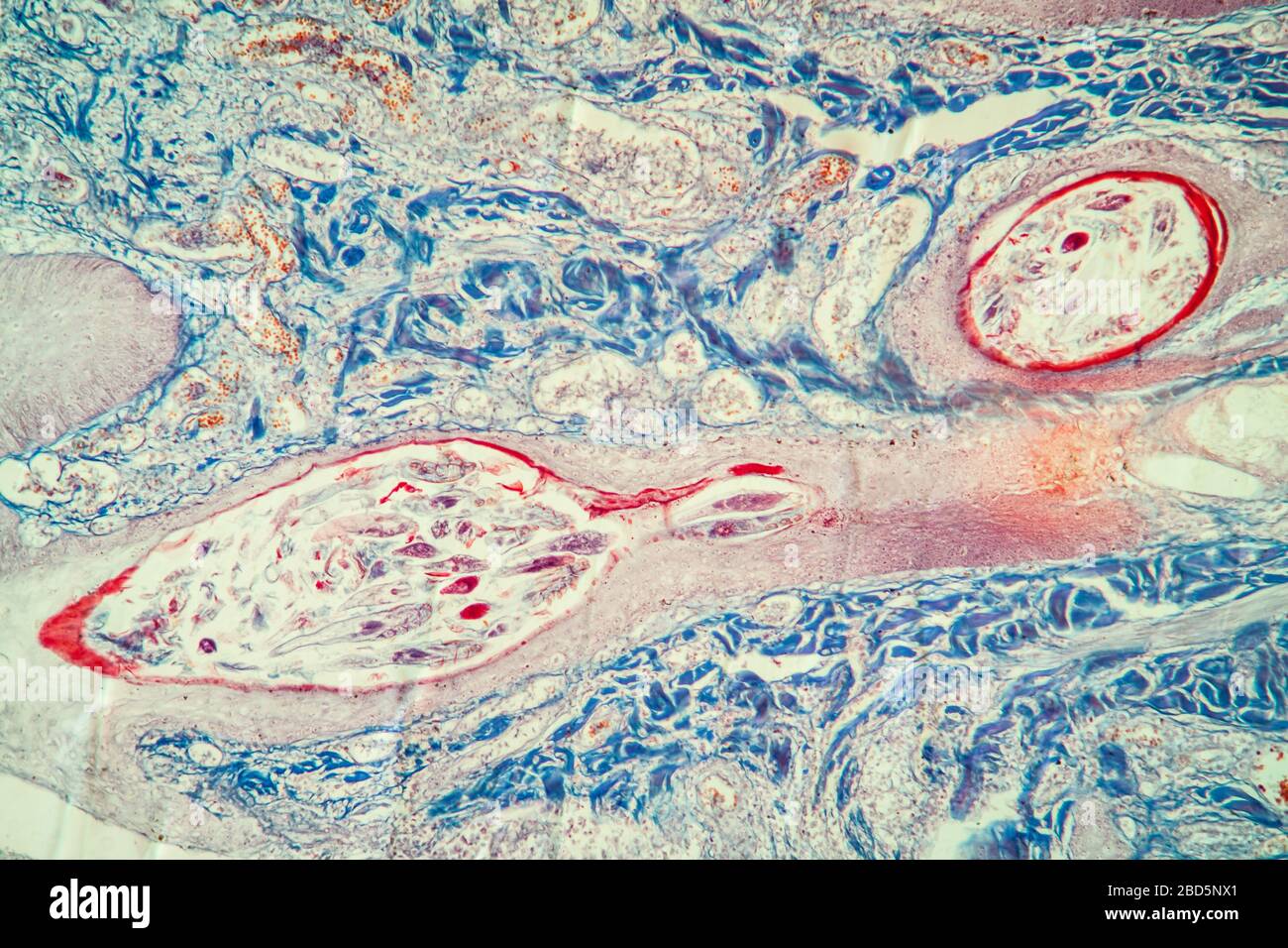 Hair follicle microscope immagini e fotografie stock ad alta ...