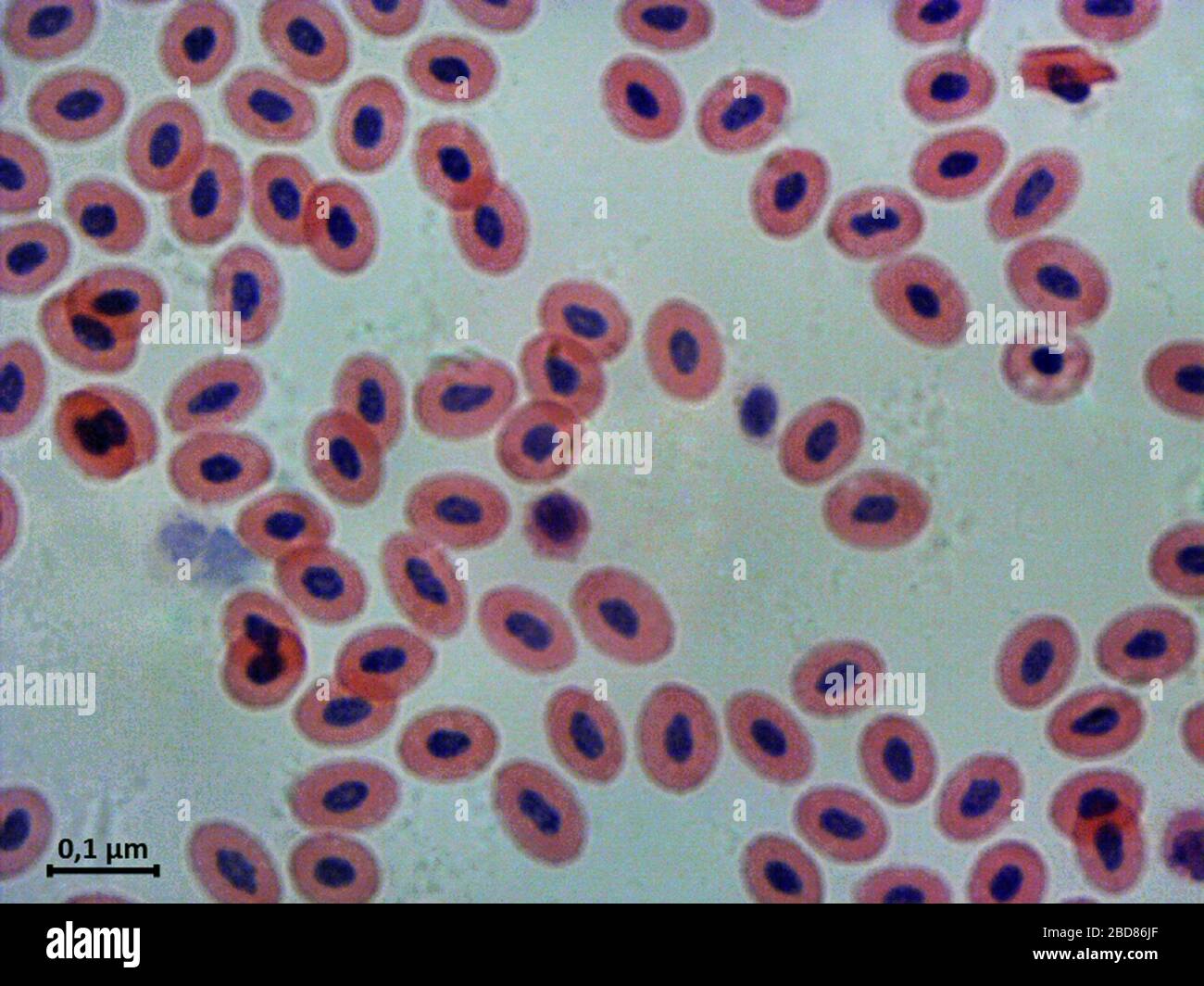 Striscio di sangue di pesce immagini e fotografie stock ad alta ...