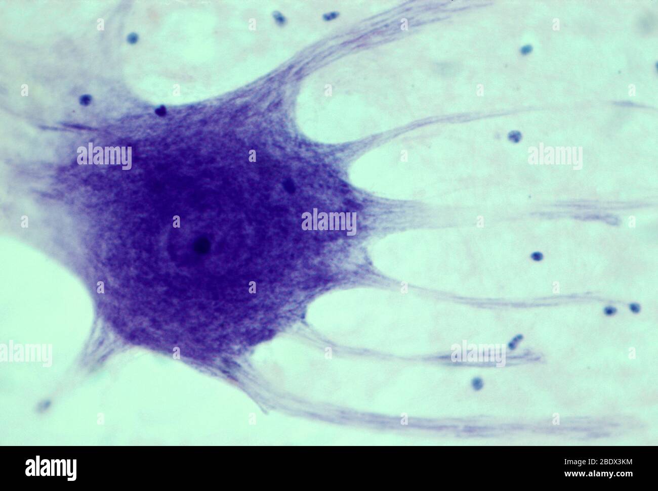 Assoni delle cellule nervose immagini e fotografie stock ad alta ...
