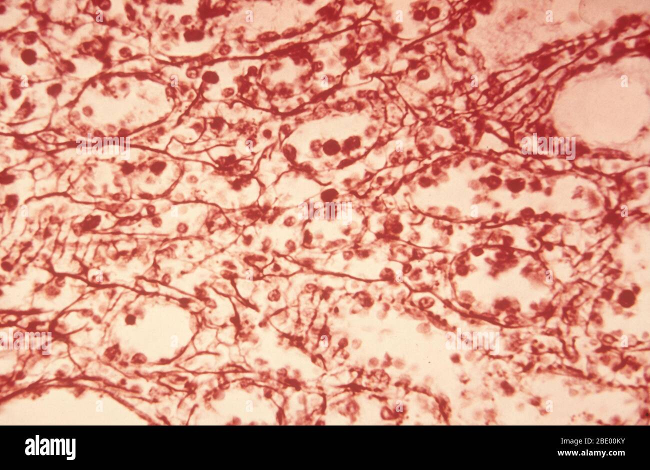 Milza di milza immagini e fotografie stock ad alta risoluzione - Alamy