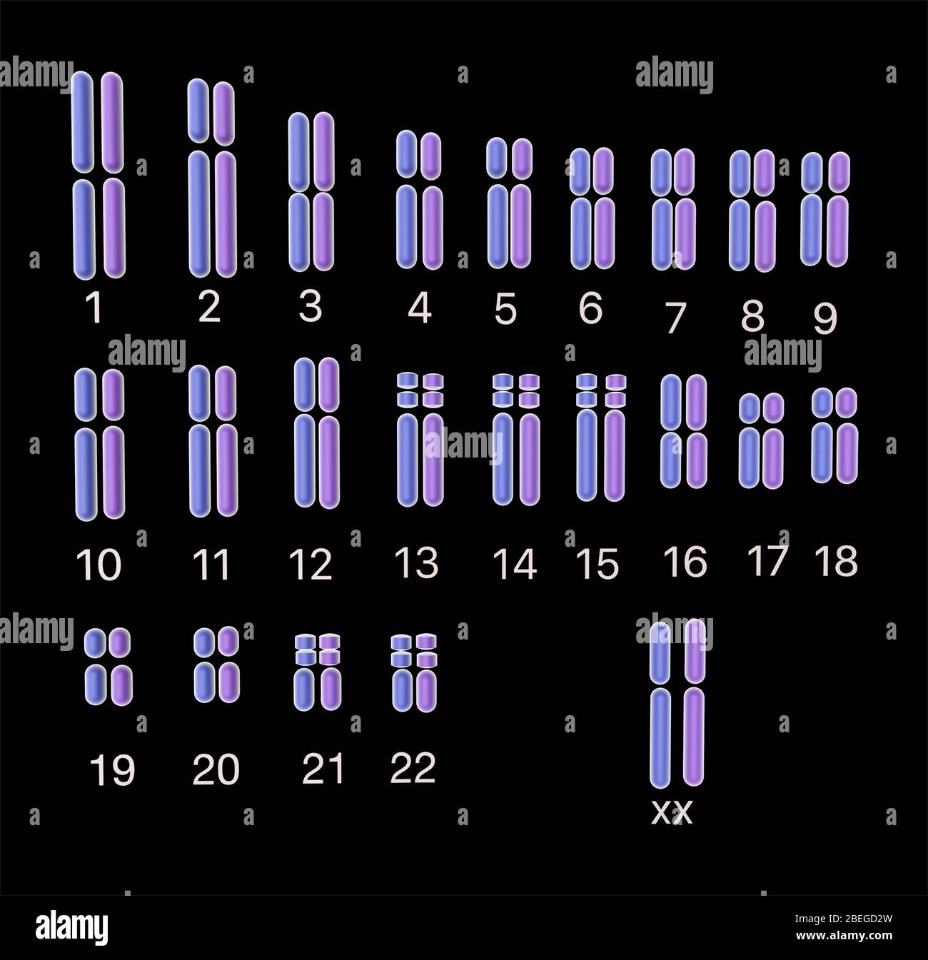 Biologia del cariotipo cromosomico immagini e fotografie stock ad alta ...