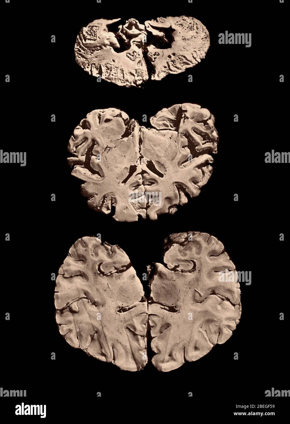 Malattia di minamata immagini e fotografie stock ad alta risoluzione - Alamy