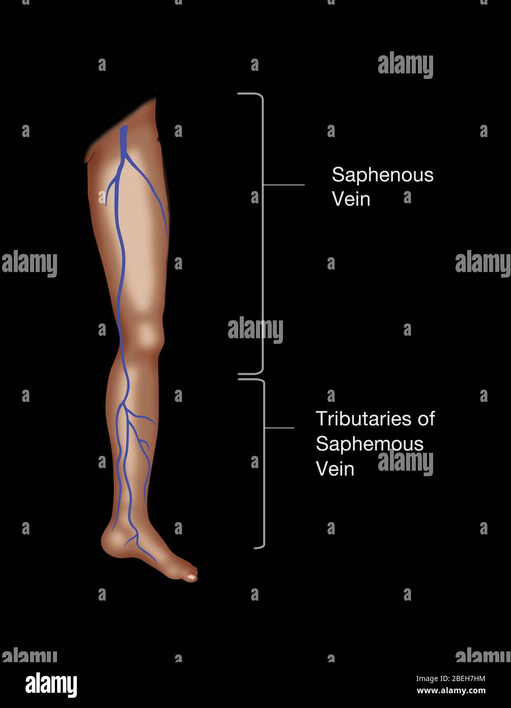 Innesto di vena coronarica immagini e fotografie stock ad alta ...