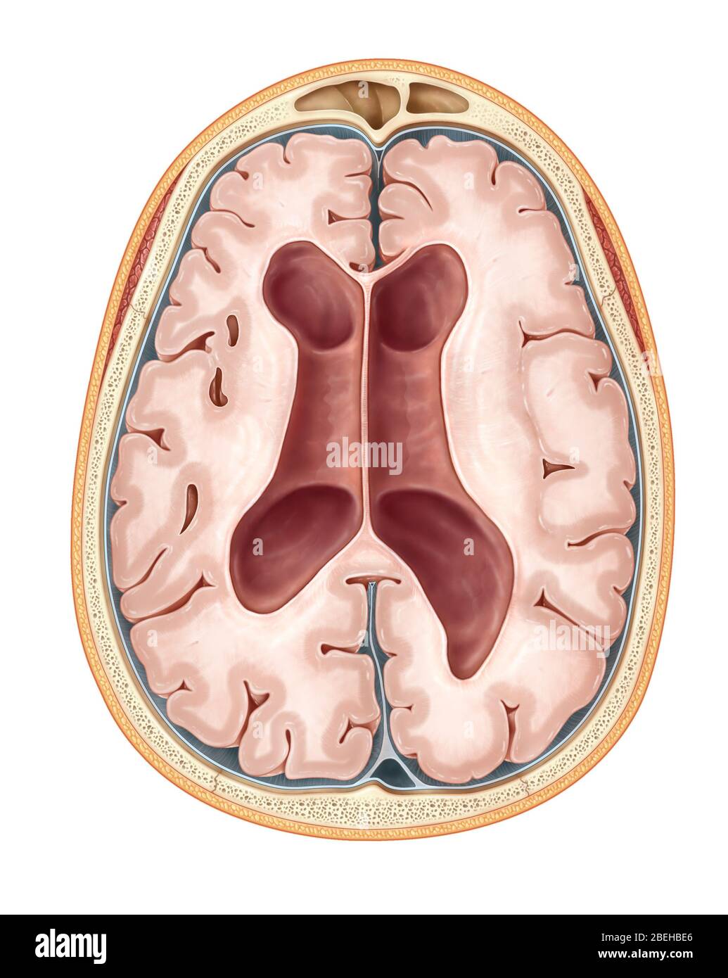 Ingrandimento anormale dei ventricoli cerebrali immagini e fotografie ...