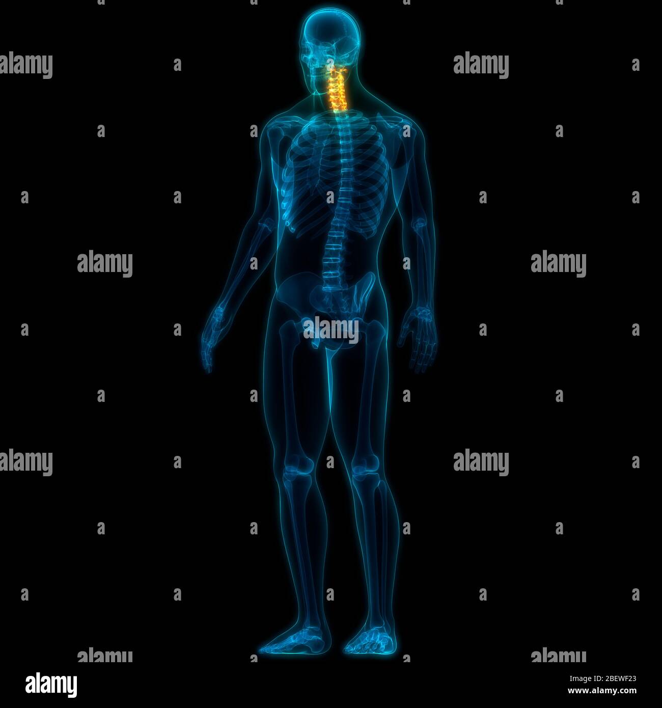 La colonna vertebrale delle vertebre cervicali di scheletro umano ...