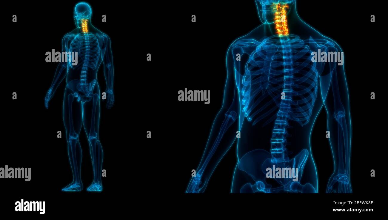 La colonna vertebrale delle vertebre cervicali di scheletro umano ...