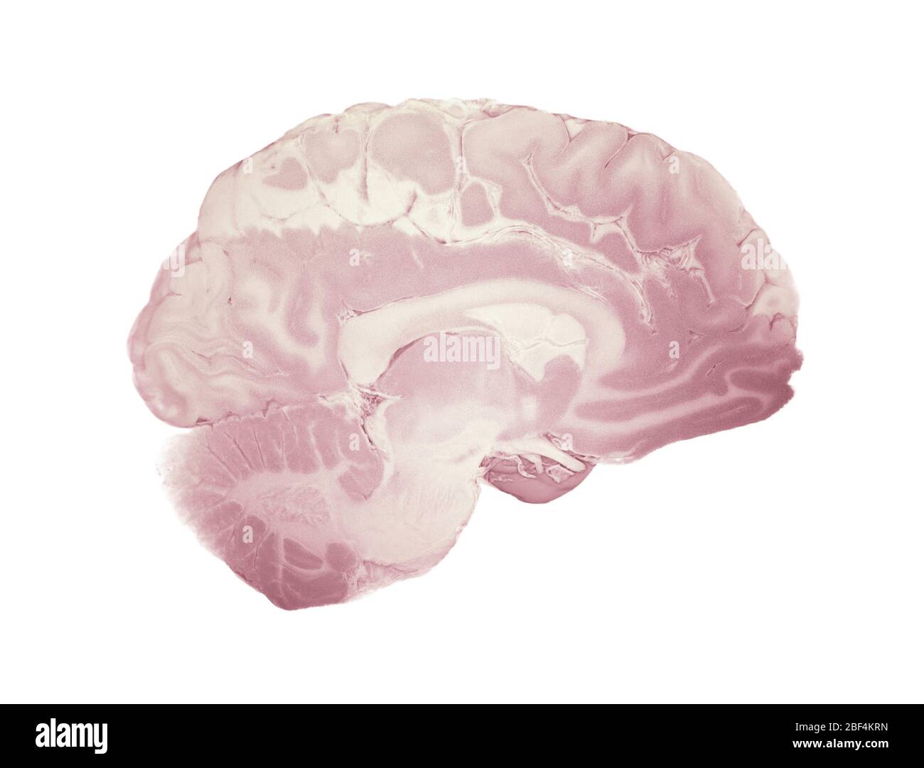 Anatomia del cervello umano immagini e fotografie stock ad alta ...