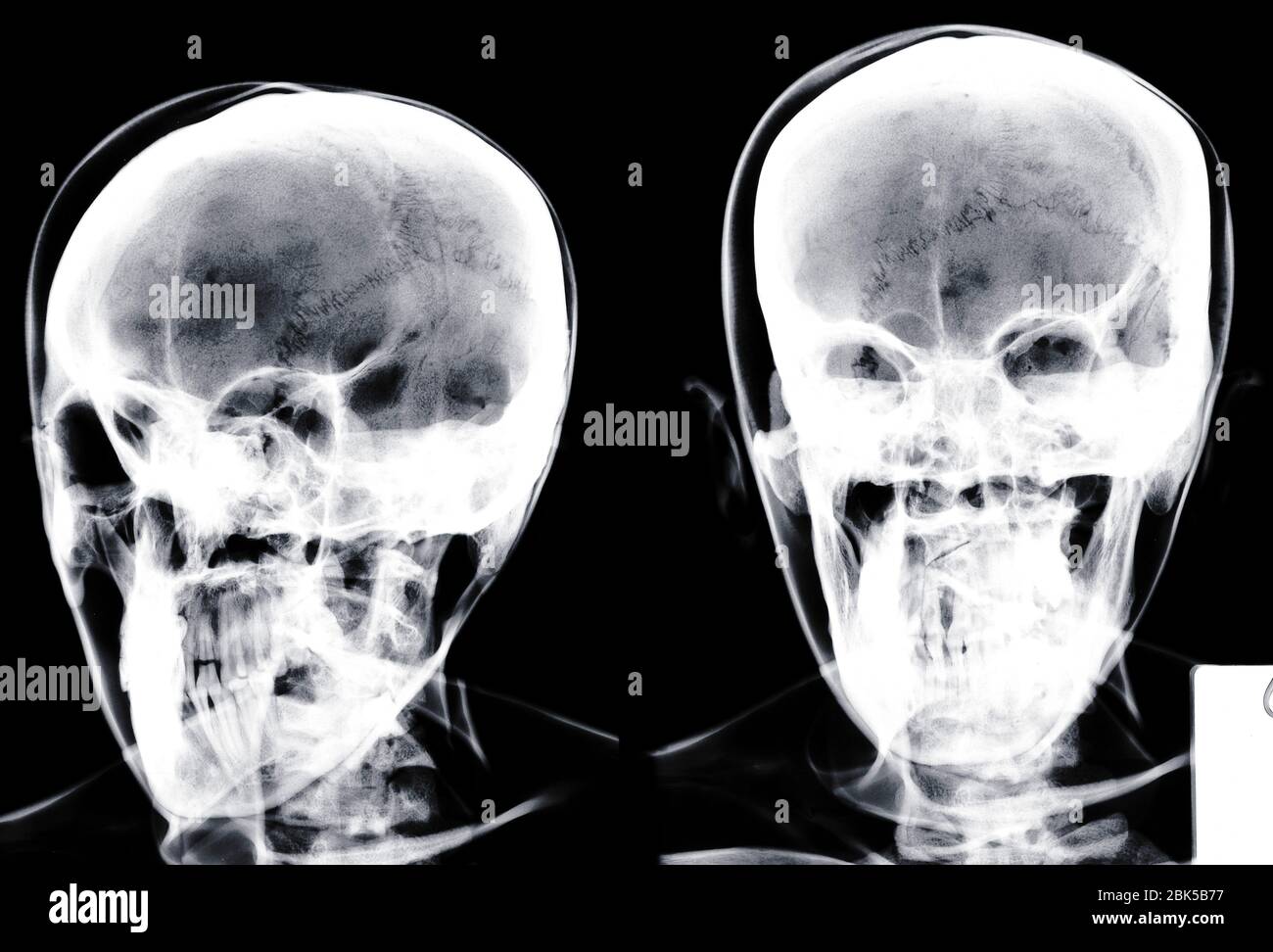 Teschi e ossa umane immagini e fotografie stock ad alta risoluzione - Alamy