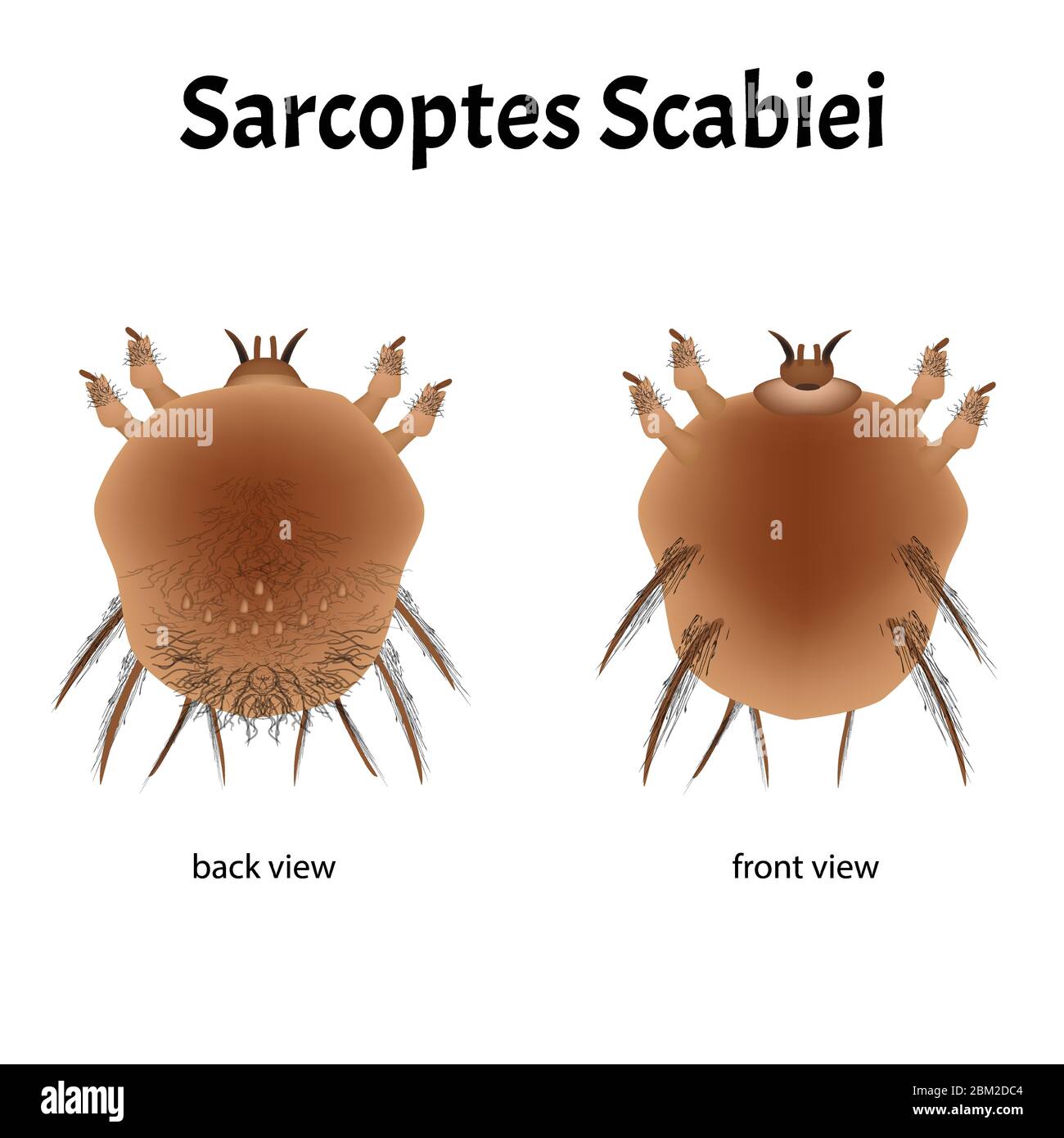 Sarcoptes scabiei immagini e fotografie stock ad alta risoluzione - Alamy