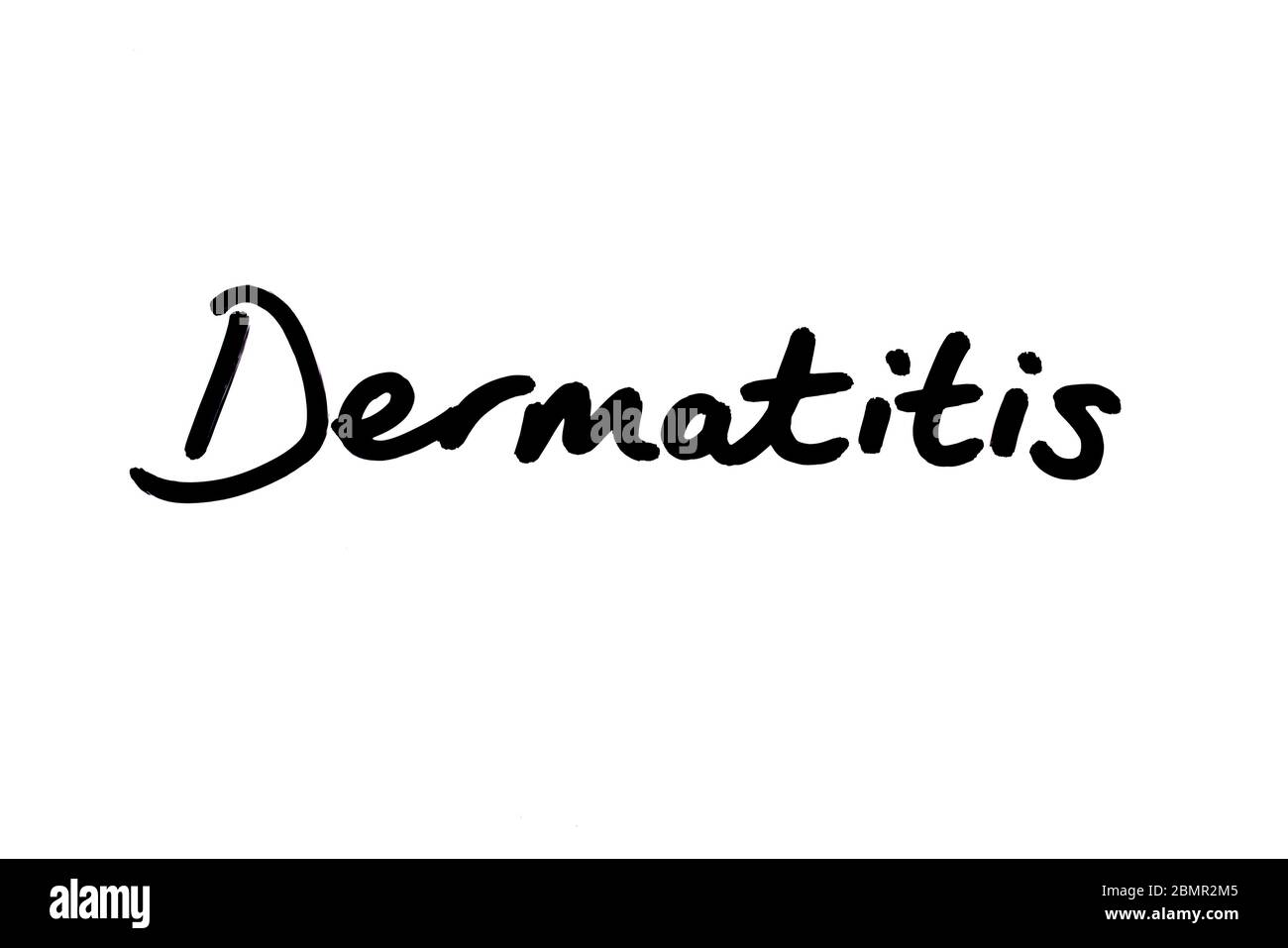 Dermatite da stasi immagini e fotografie stock ad alta risoluzione - Alamy