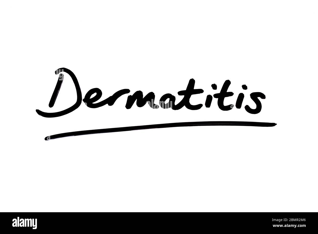 Dermatite da stasi immagini e fotografie stock ad alta risoluzione - Alamy