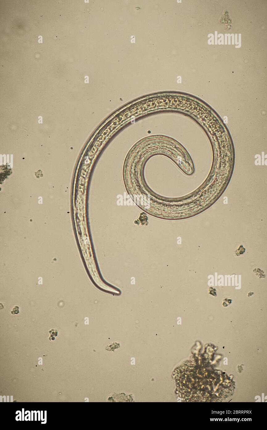 Trichinella spiralis - microscopio parassita nematoda worm Foto stock ...