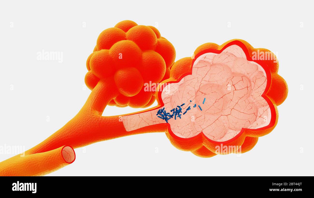 Alveolo polmonare 3d immagini e fotografie stock ad alta risoluzione ...