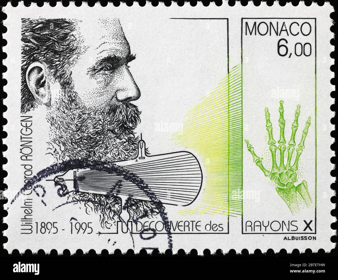 Radiazione elettromagnetica a raggi x rontgen immagini e fotografie ...