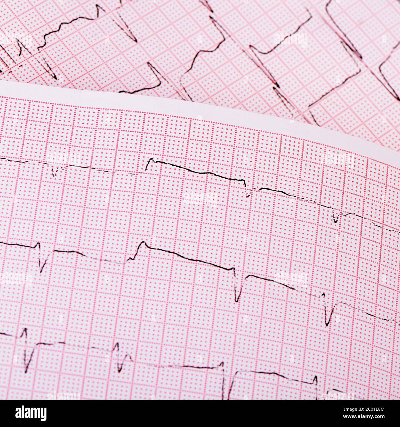 Diagrama de cardiograma immagini e fotografie stock ad alta risoluzione ...