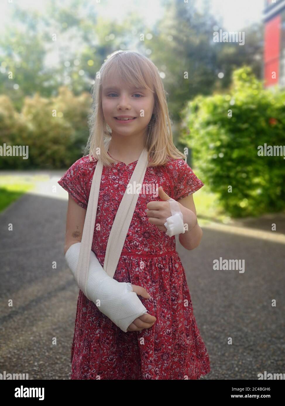 Polso ingessato immagini e fotografie stock ad alta risoluzione - Alamy