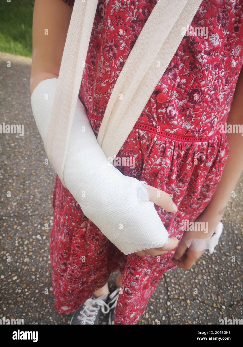 Fracturado niño immagini e fotografie stock ad alta risoluzione - Alamy