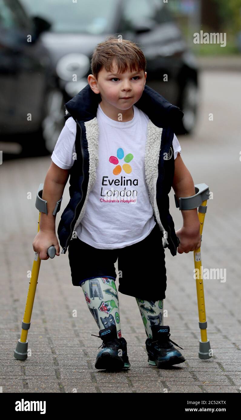 Chi usa protesi alle gambe immagini e fotografie stock ad alta ...