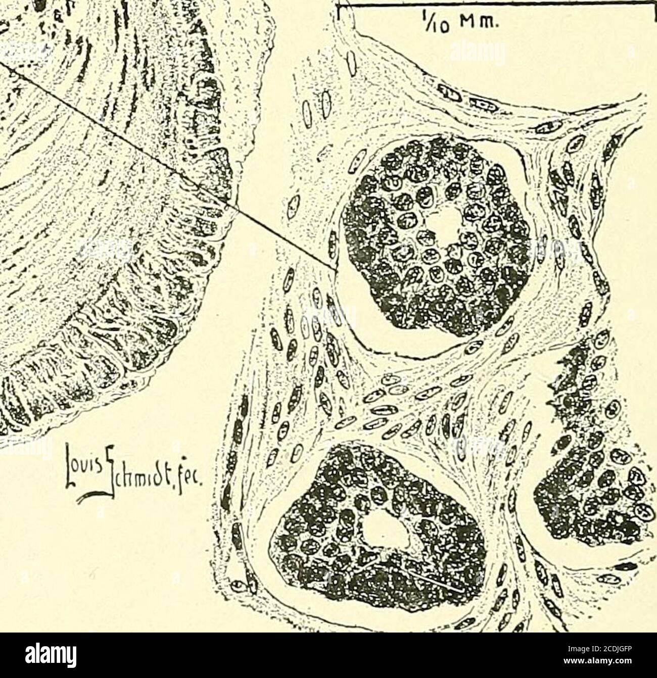 Appendix vermiformis immagini e fotografie stock ad alta risoluzione ...