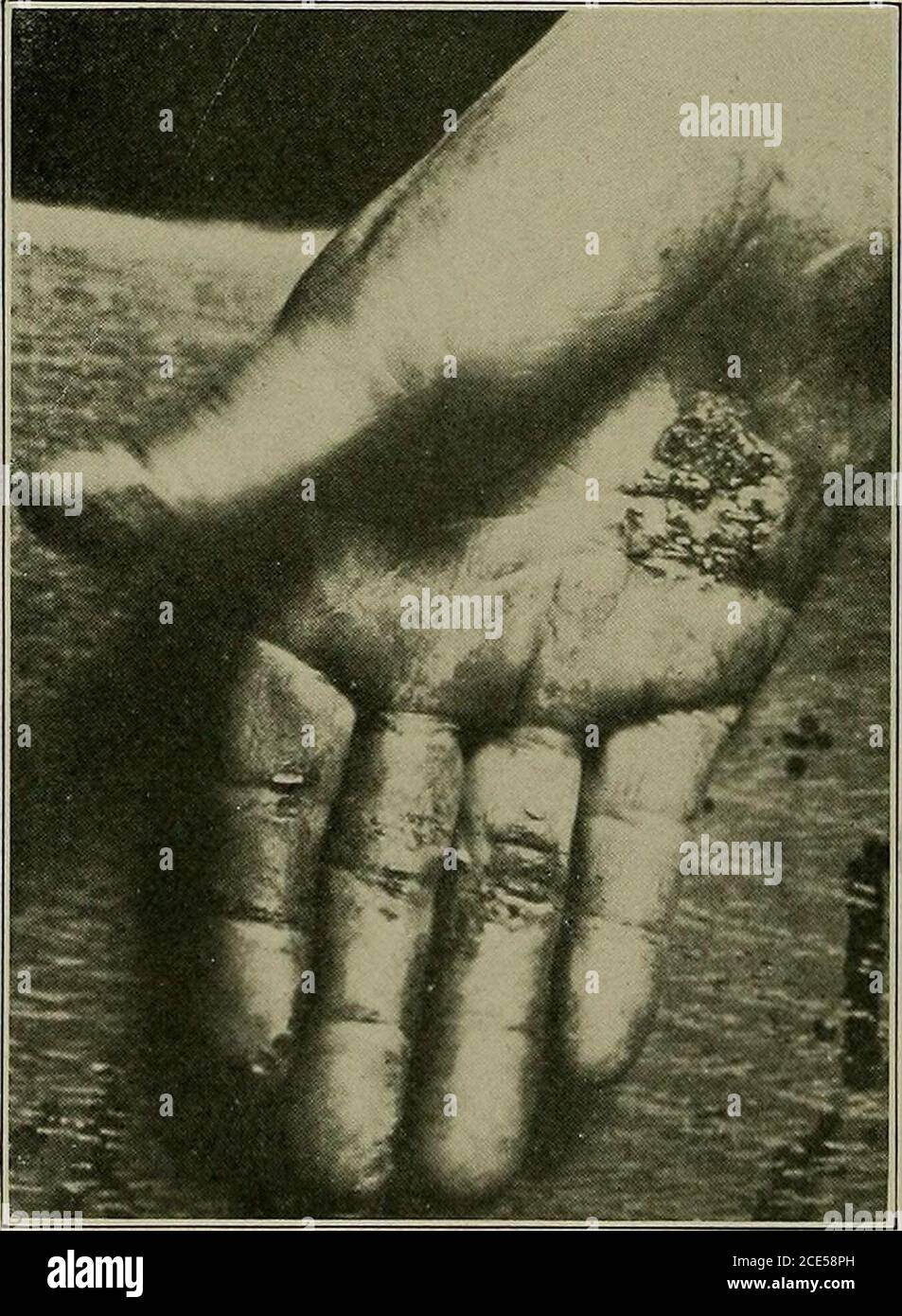 Lesioni cutanee immagini e fotografie stock ad alta risoluzione - Alamy