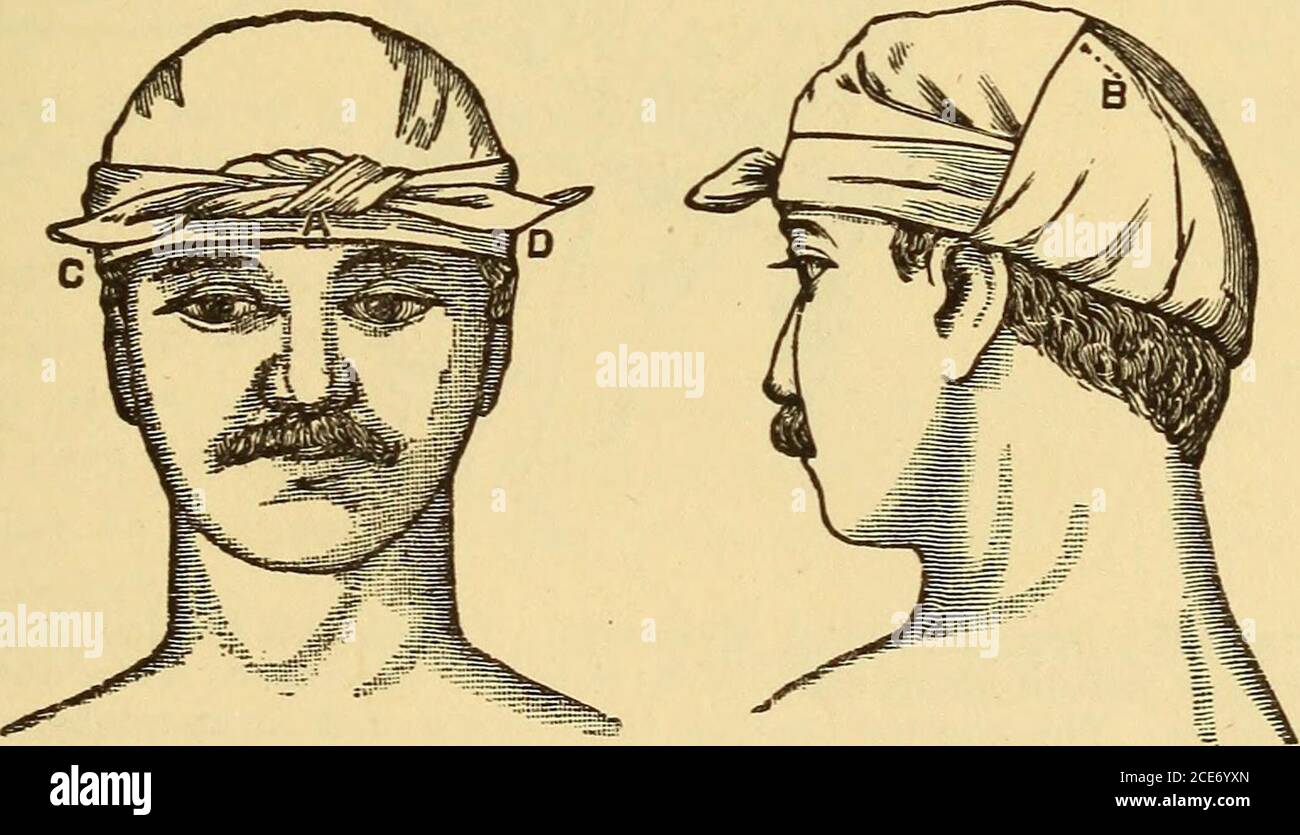 External occipital protuberance immagini e fotografie stock ad alta ...