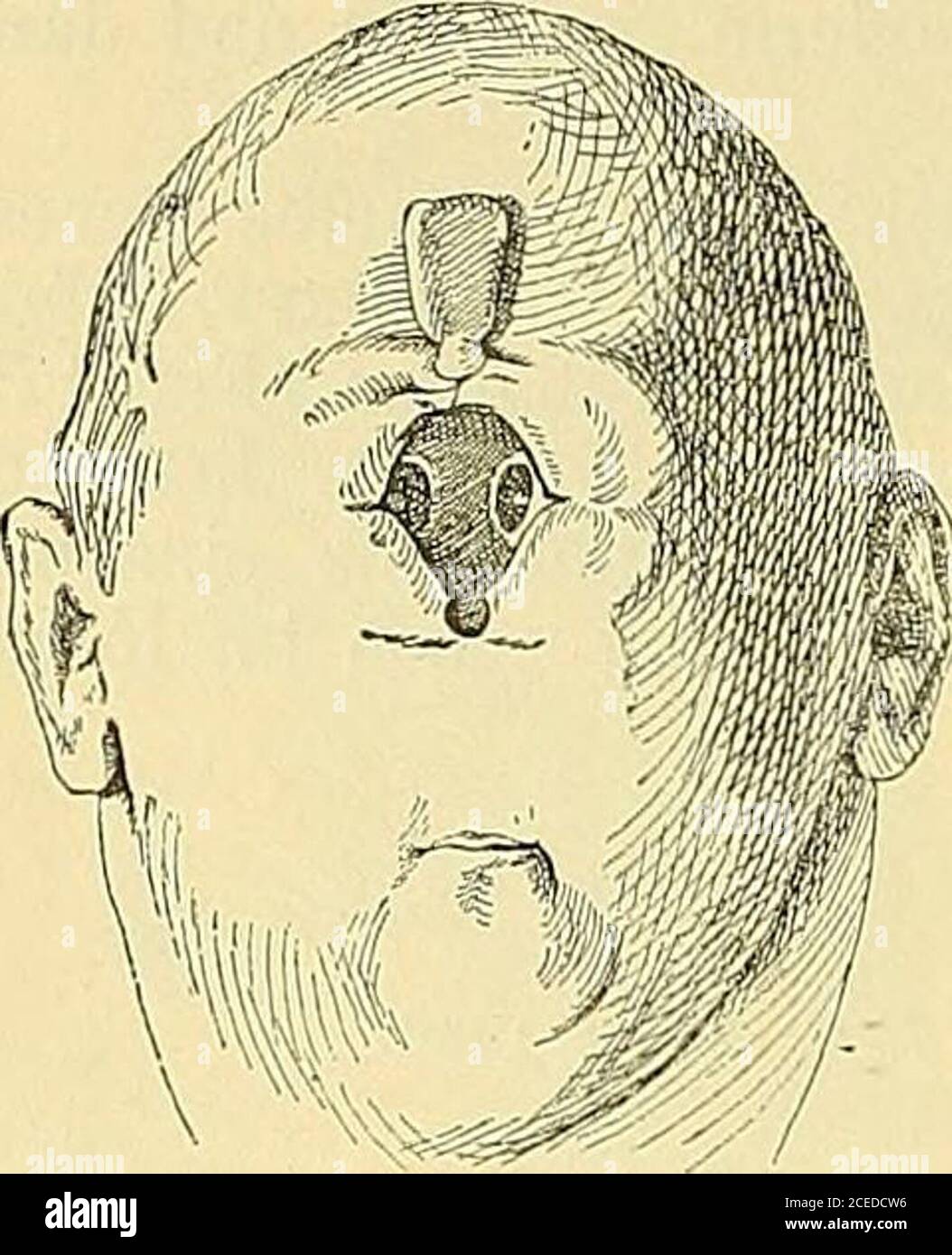 Anatomie der blase immagini e fotografie stock ad alta risoluzione - Alamy