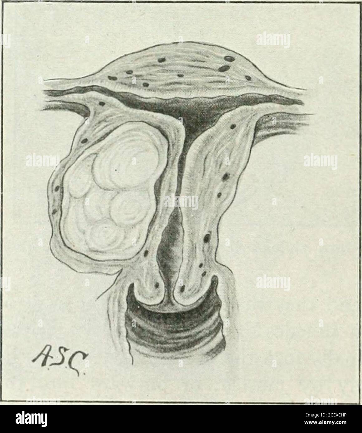 . Un manuale di gynæcology e chirurgia pelvica, per studenti e ...
