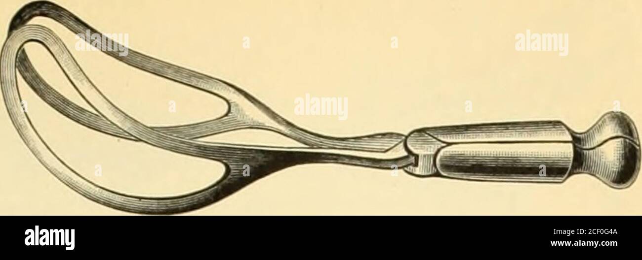 Prolasso uterino immagini e fotografie stock ad alta risoluzione - Alamy