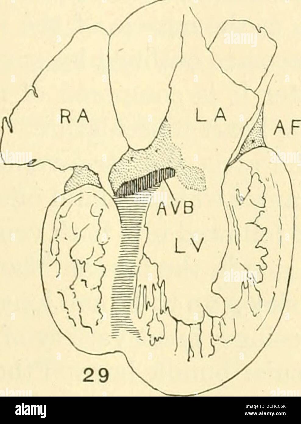 Atrio ventricular immagini e fotografie stock ad alta risoluzione - Alamy