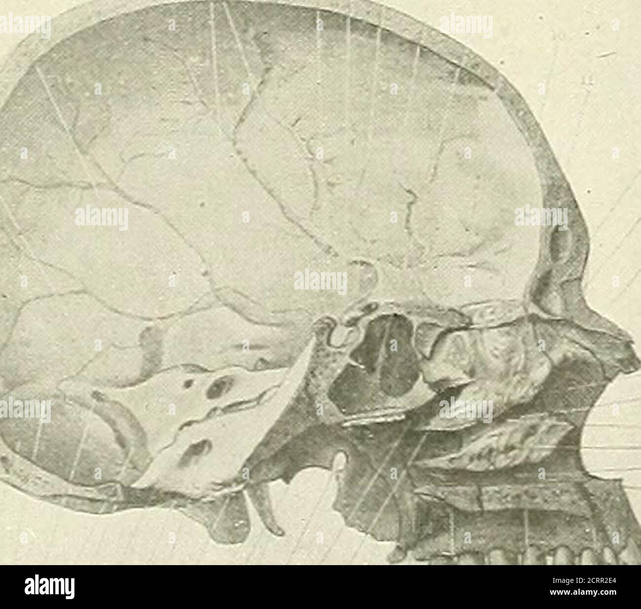 . I principi e la pratica della tecnica roentgenologica . Fig. 205. Fig ...