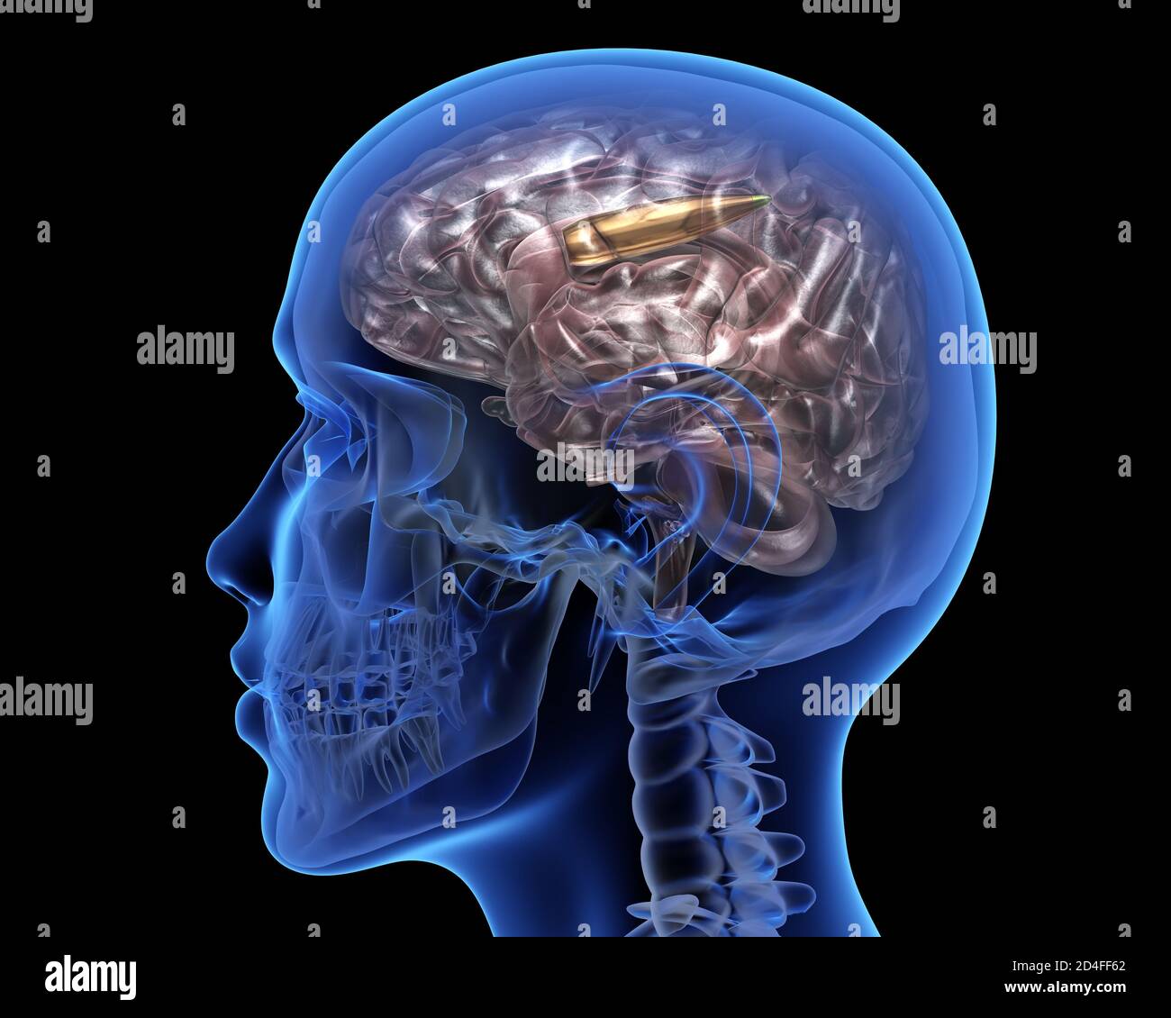 Proiettile umano immagini e fotografie stock ad alta risoluzione - Alamy