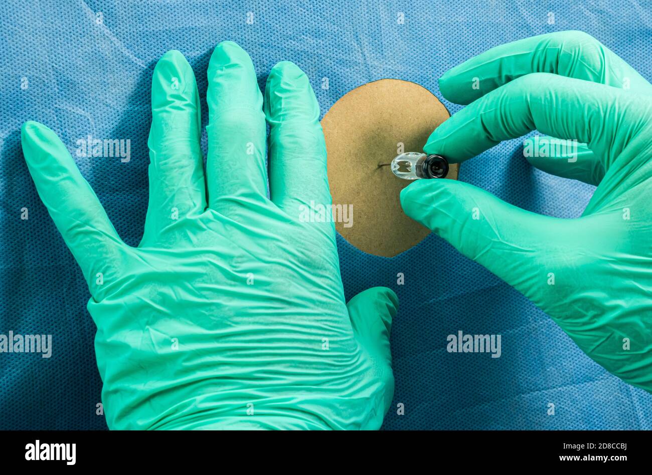 Spazio subaracnoideo immagini e fotografie stock ad alta risoluzione ...