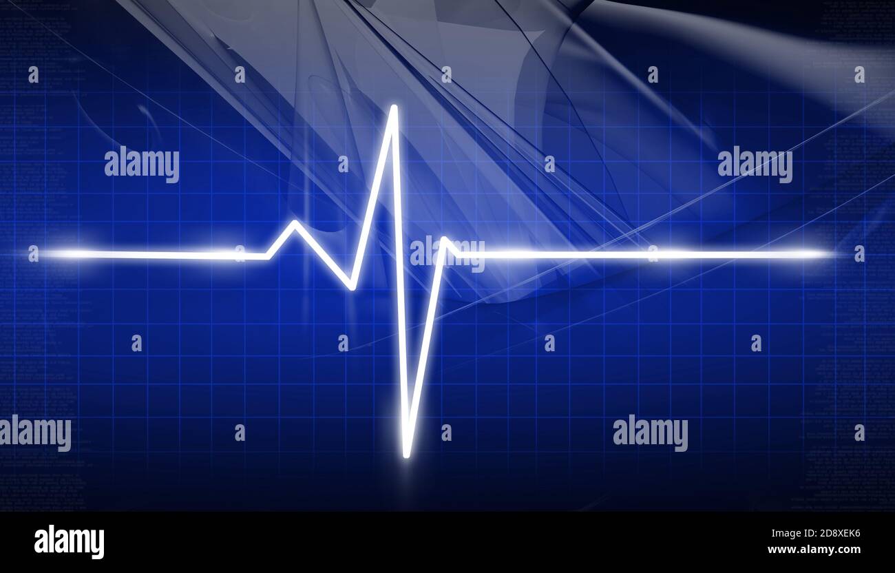 Tracciato ecg normale immagini e fotografie stock ad alta risoluzione ...