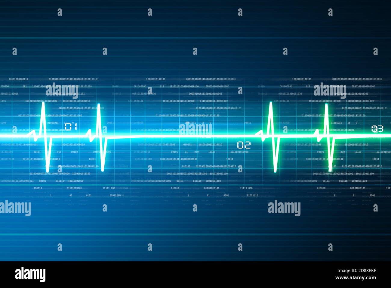 Tracciato ecg normale immagini e fotografie stock ad alta risoluzione ...